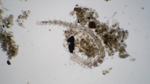 Aquatic Microorganisms Observed Under Microscope Stock Footage Video ...
