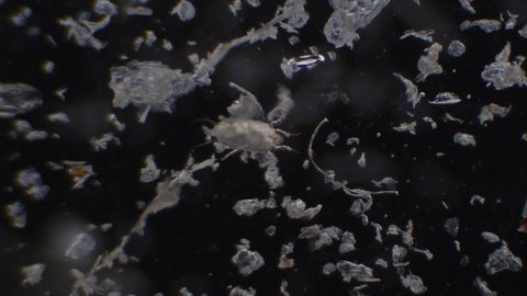 House Dust Mites Observed Under Microscope Stock Footage Video (100% ...