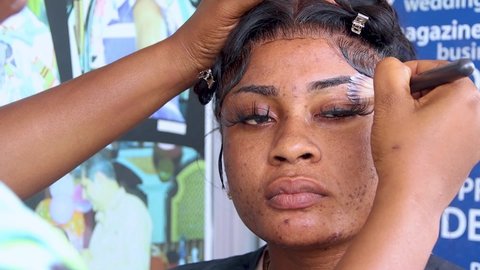 Woman Rough Skin Black Spot On Stock Footage Video (100% Royalty-free ...