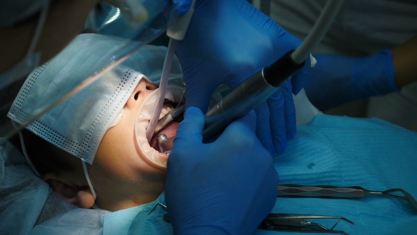 19,148 Anesthesia Stock Video Footage - 4K and HD Video Clips ...