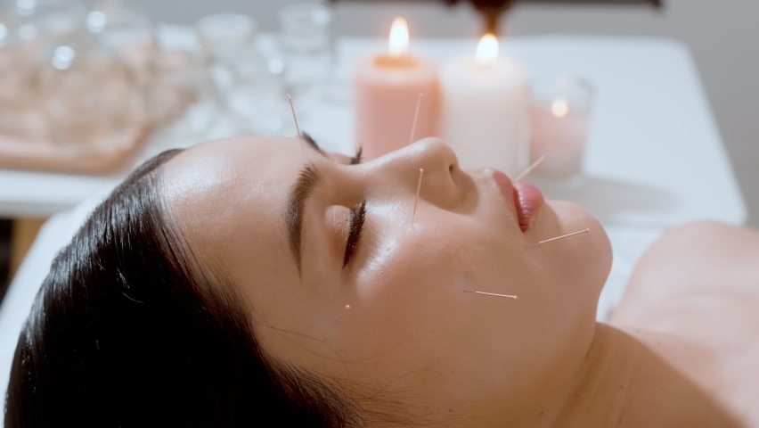 Acupuncture Stock Videos – Royalty-Free HD & 4K Videos | Pond5