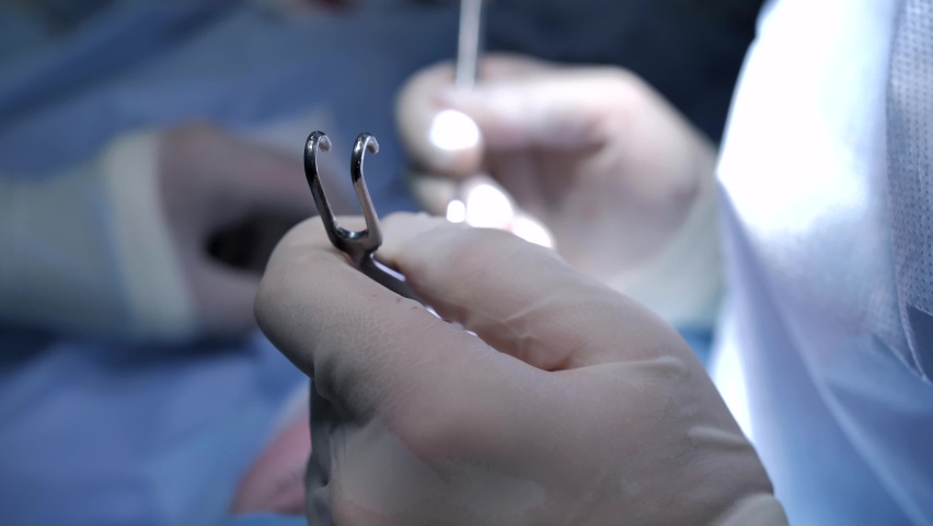 Surgery Stock Video Footage | Royalty Free Surgery Videos | Pond5