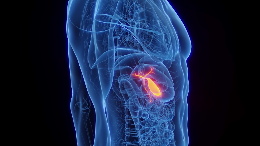 5 Gallbladder Polyp Stock Video Footage - 4K and HD Video Clips ...