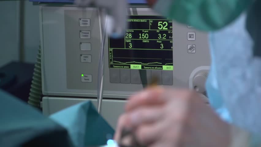 Ecg Monitor in Operating Room. Stock Footage Video (100% Royalty-free ...