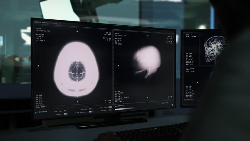 Download X-ray Scan Film Transitions | After Effects - Videohive ...