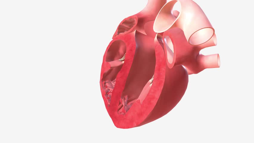 Atrial Fibrillation Stock Footage ~ Royalty Free Stock Videos | Pond5