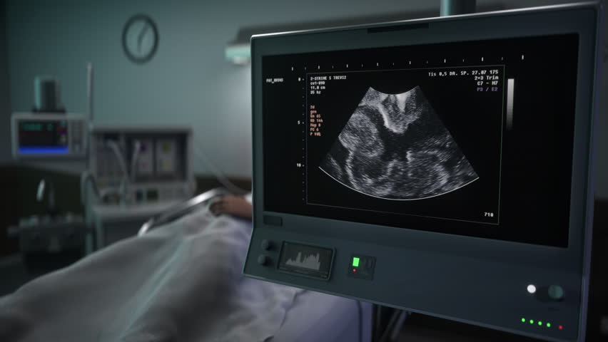 6,736 Ultrasound Machine Stock Video Footage - 4K and HD Video Clips ...