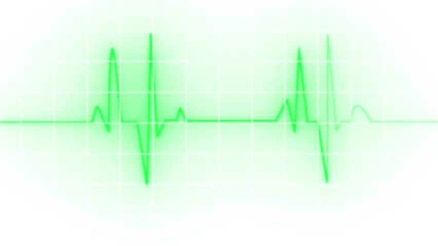 Animated Heartbeat Monitor