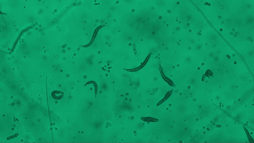 Nematode Worms Seen 100x Magnification Phase Stock Footage Video (100% ...