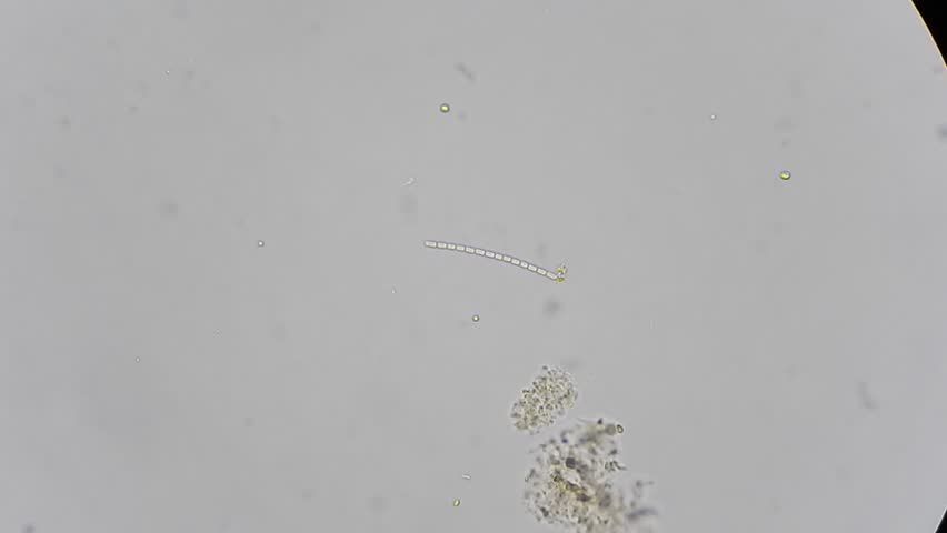 cyanobacteria movements under microscope magn 400x Stock Footage Video ...