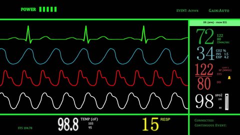 Looping Animation Medical Hospital Monitor Normal Stock Footage Video ...