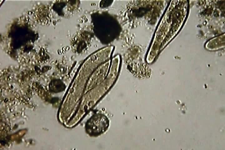Educational Microscopic. Two Conjugating Paramecia Stock Footage Video ...