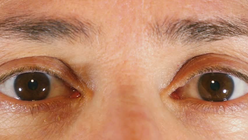 16 Fuzzy eyebrows Stock Video Footage - 4K and HD Video Clips ...