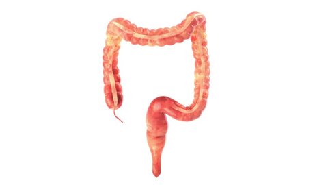 Diagram Shows Types Ulcerative Colitis Proctitis Stock Illustration ...