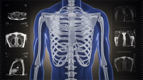 Chest Xrays Under 3d Image Lungs Stock Footage Video (100% Royalty-free ...