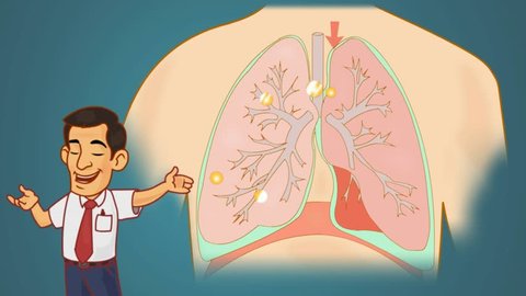 Cute Infographic About Epilepsy Disease Stock Vector (Royalty Free ...