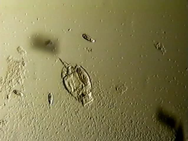 educational microscopic rotifer lepadella eating spirilla Stock Footage ...