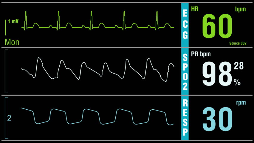 MONITORING-SPO2 Footage, Videos and Clips in HD and 4K - Avopix.com