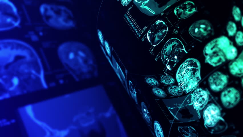 medical clinical background ct scans x-ray Stock Footage Video (100% ...