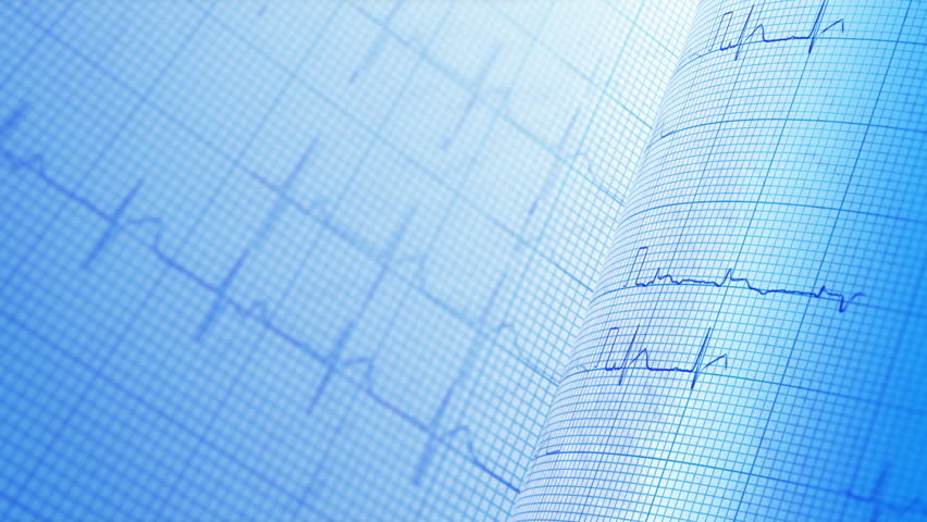 Heart Rate, Electrocardiogram, Ecg Medical Stock Footage Video (100% ...