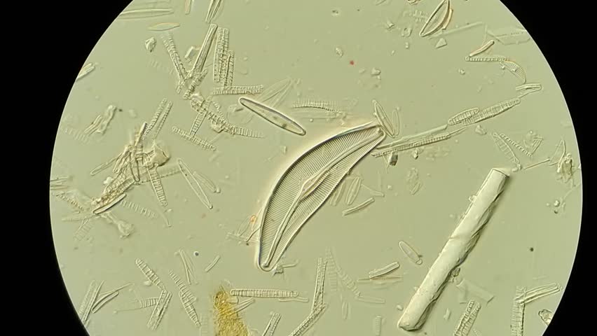 diatom algae cell walls made silica Stock Footage Video (100% Royalty ...