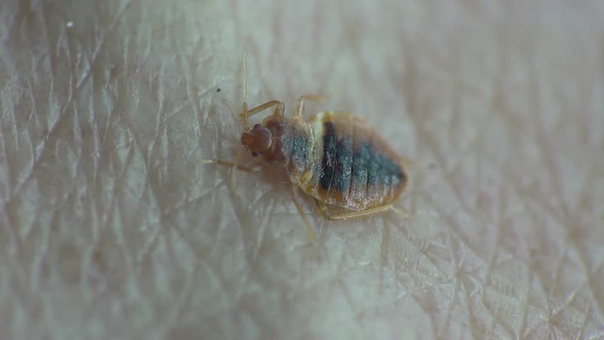 bedbug insect parasite on human skin Stock Footage Video (100% Royalty ...
