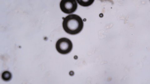 Water Bubbles Under Microscope Stock Footage Video (100% Royalty-free ...