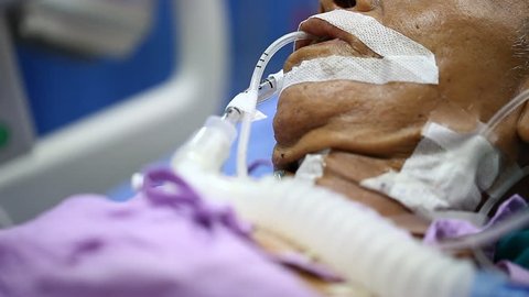 Patient Endotracheal Tube Orogastric Tube Stock Footage Video (100% ...