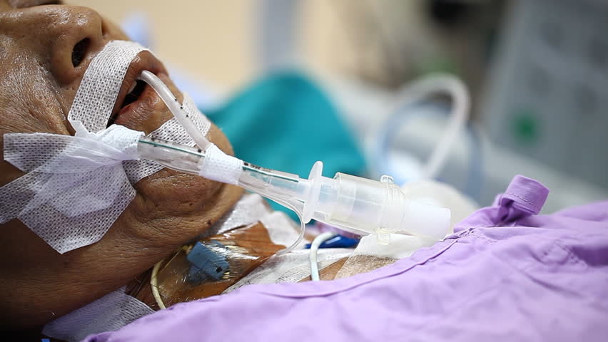 TRACHEAL-INTUBATION Footage, Videos and Clips in HD and 4K - Avopix.com