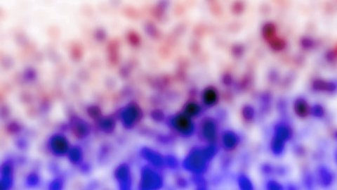 Blood Smear Red Blood Cells Under Stock Footage Video (100% Royalty ...