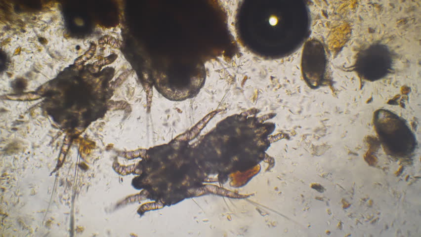 Otodectes Cynotis: Videos de stock; videoclips en 4K y HD | Shutterstock