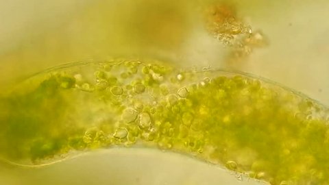 Seaweed Algae Vaucheria Under Microscope Magnification Stock Footage ...