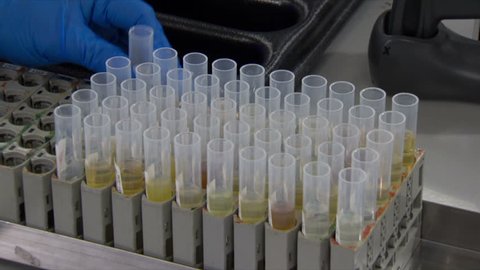 Urine Vials Ready Drug Analysis Testing Stock Footage Video (100% ...