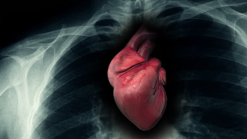 cg animation sick human heart Stock Footage Video (100% Royalty-free ...