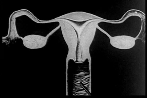 Fallopian tube Stock Video Footage - 4K and HD Video Clips | Shutterstock