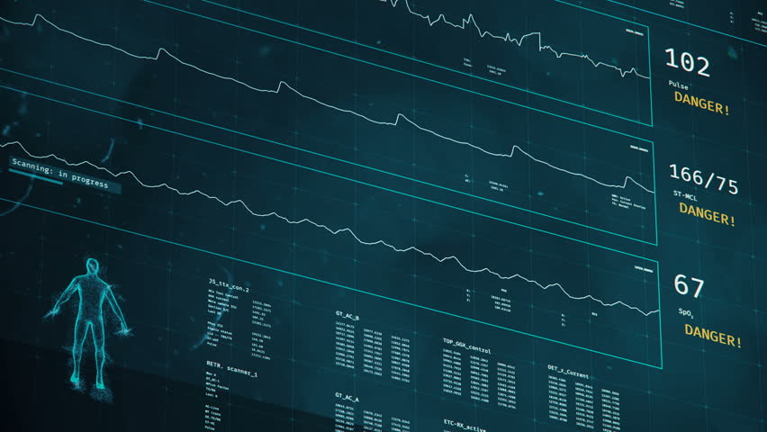 Icu Screen with Critical Condition, Stock Footage Video (100% Royalty ...