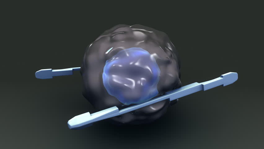 Urine Crystals Uric Acid Stock Video Footage - 4K and HD Video Clips ...