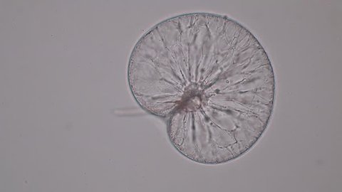 Noctiluca Dinoflagellate Marine Protozoa Under Microscope Stock Footage ...