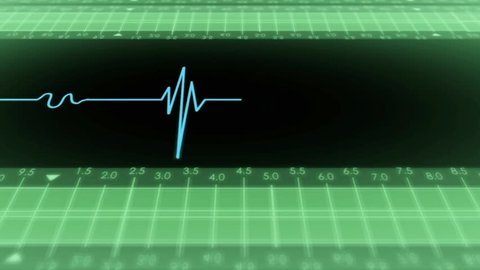 Heartbeat Monitor Stock Footage Video (100% Royalty-free) 21365434 ...