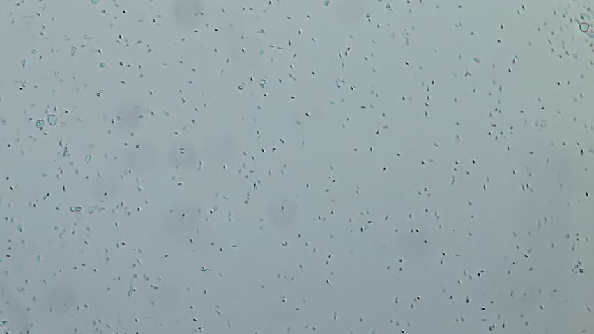 Sperm Magnified Phase Contrast 100x 스톡 동영상 비디오(100% 로열티 프리) 2158841 ...