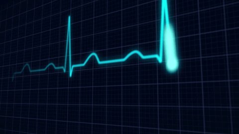 Heartbeat Line Graph Heart Rhythm On Stock Footage Video (100% Royalty ...