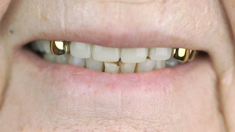 Mouth Old Woman Aged 80s False Stock Footage Video (100% Royalty-free ...