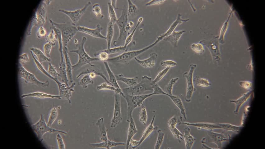 Tumor Cells at Optical Microscope Stock Footage Video (100% Royalty ...