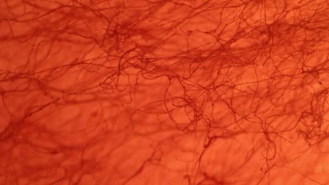 Retinal Vessels Under Microscope Stock Footage Video (100% Royalty-free ...