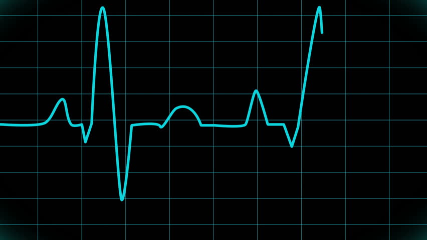 cardiogram animated ekg display Stock Footage Video (100% Royalty-free ...