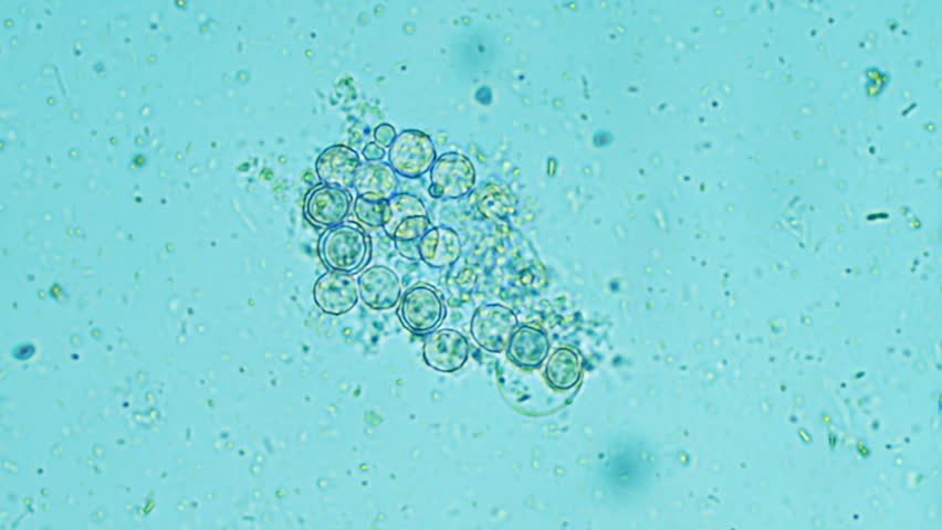 Insect Tissue Sample (hd) 600x Stock Footage Video (100% Royalty-free ...