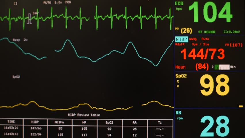 Vitalzeichen-Monitor im Krankenhaus: Stockvideos & Filmmaterial (100 % ...