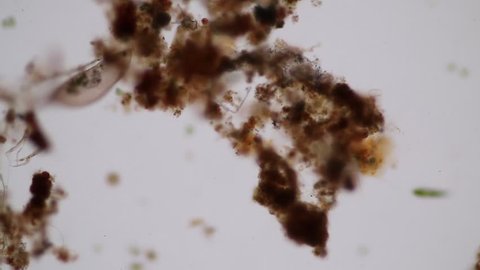 Zoo Protista Drop Under Microscopic View Stock Footage Video (100% ...