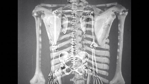 United States 1950s Animation Spinal Column Stock Footage Video (100% ...