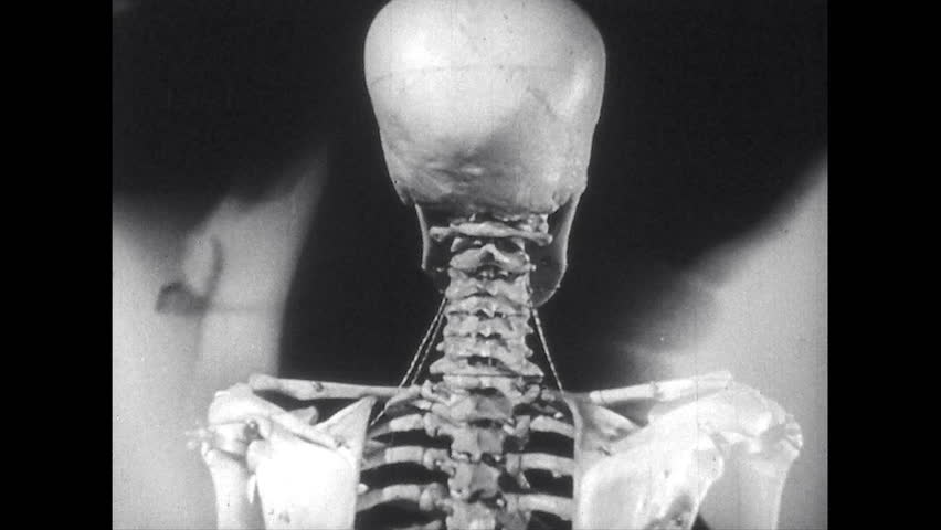 united states 1950s x-ray photograph spine Stock Footage Video (100% ...